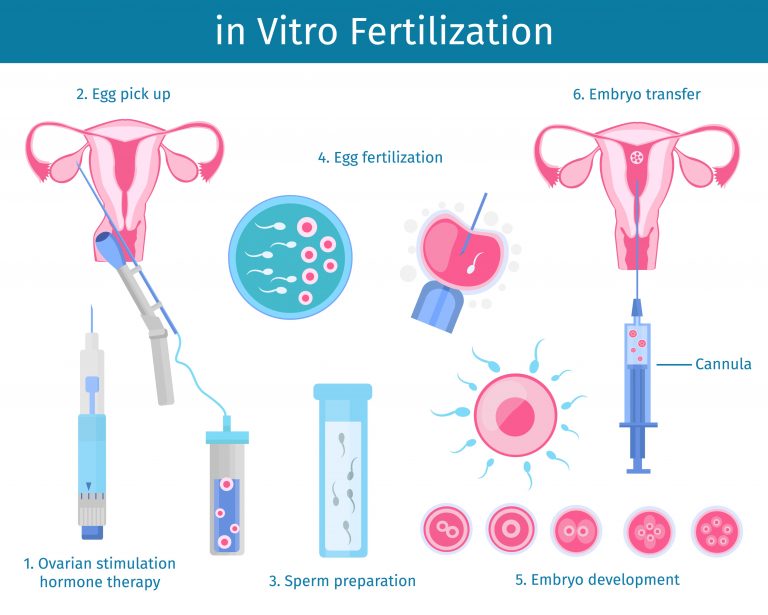 How long does IVF take? - KJK Hospital